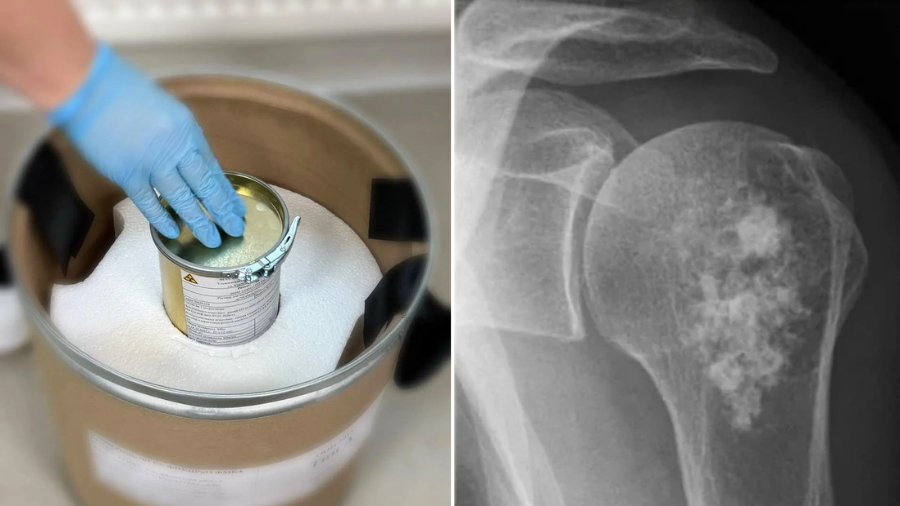 Rusia empieza a emplear un innovador medicamento para el tratamiento de ...